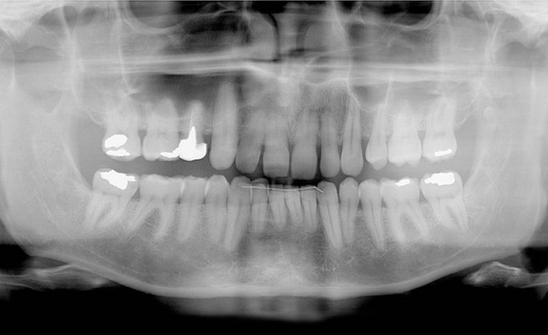 Rtg dijagnostika - Stomatološka poliklinika "dr. Percač"